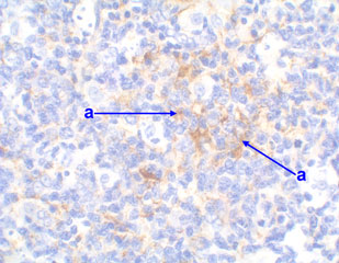 The Germinal Centre – Pathologia