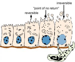 Necrosis – Pathologia