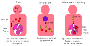Hypersensitivity – Pathologia
