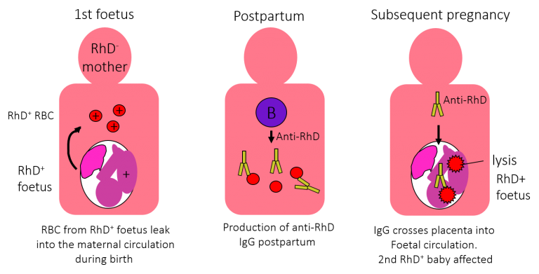 Hypersensitivity – Pathologia